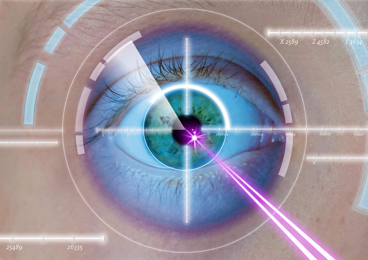 How the Latest in Refractive Technology at ICON Eyecare Can Correct ...